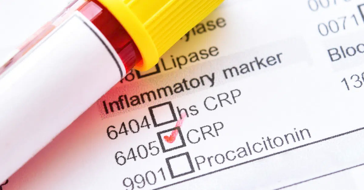 Understanding CRP Levels (Inflammation Markers) – ProleevaMax